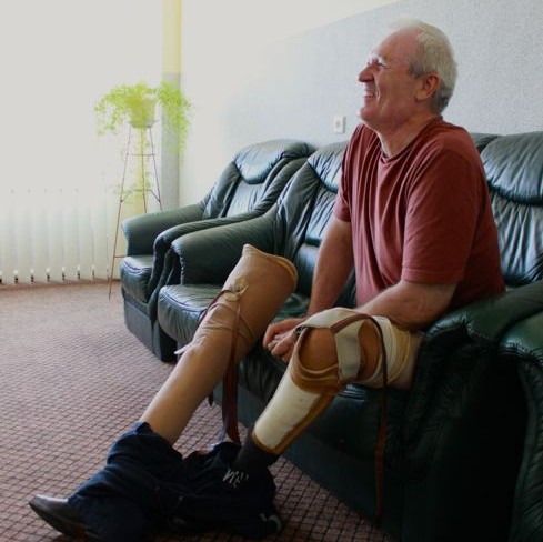 Living without limbs: veterans in war-torn Ukraine - Euromaidan Press